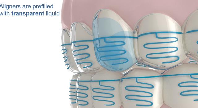 Actival SA - startup.ch