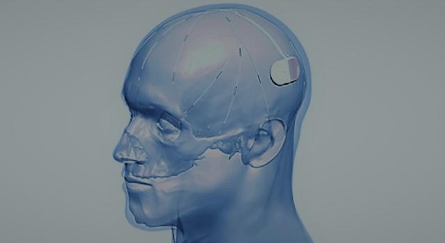 Epios SA - startup.ch